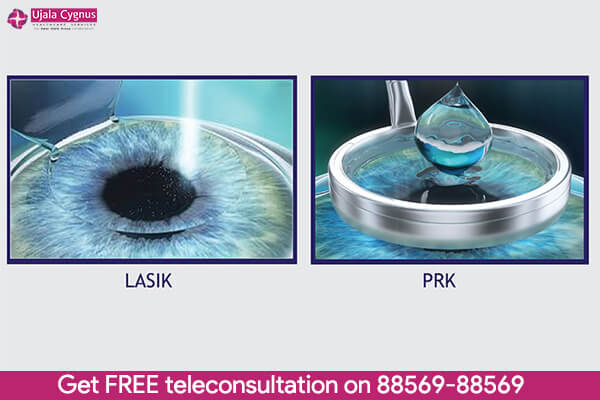 What Is The Difference Between Lasik And PRK?