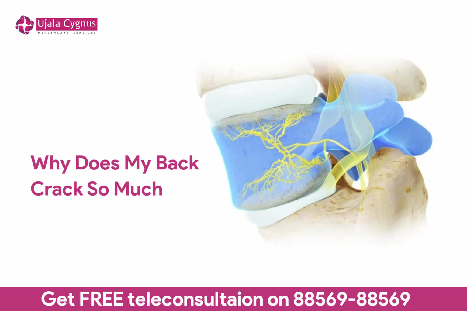 Why Does My Spine Crack So Much?